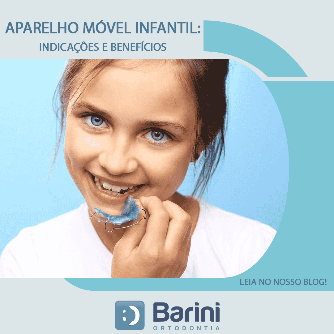 Aparelho móvel infantil | Barini Odontologia