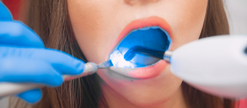 Tratamentos com Laserterapia na Odontopediatria. | Barini Odontologia