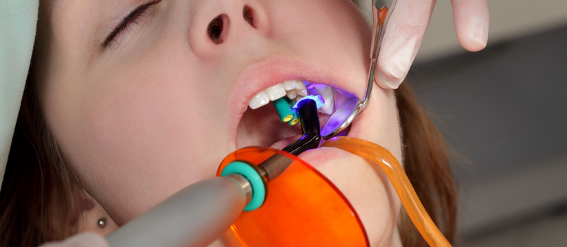 Tratamentos com Laserterapia na Odontopediatria. | Barini Odontologia