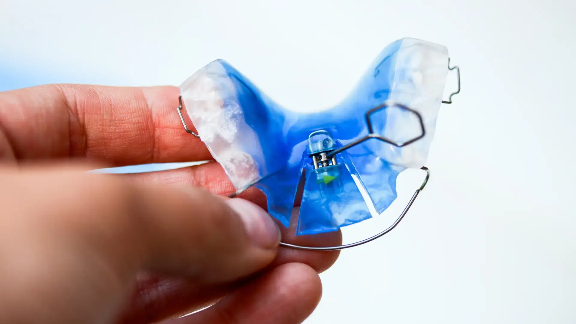 Ortopedia Funcional dos Maxilares - Barini Odontologia